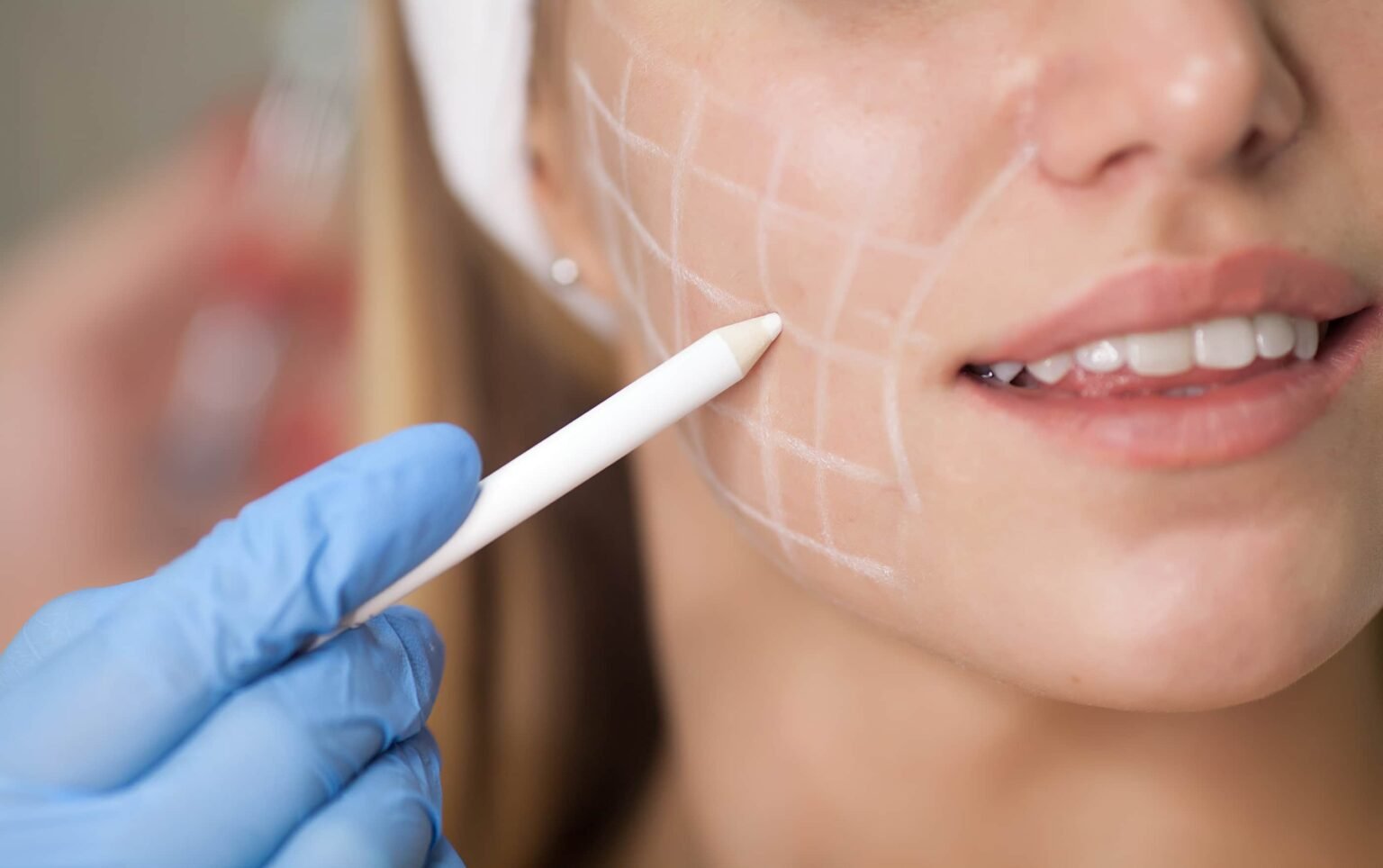 Cheek Augmentation – Horizons Medical Care